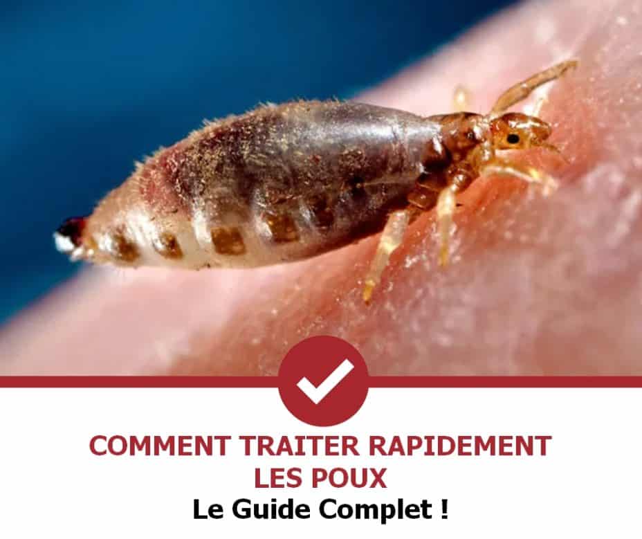 Se débarrasser des araignées (10 méthodes en 2022) - Stop Nuisible